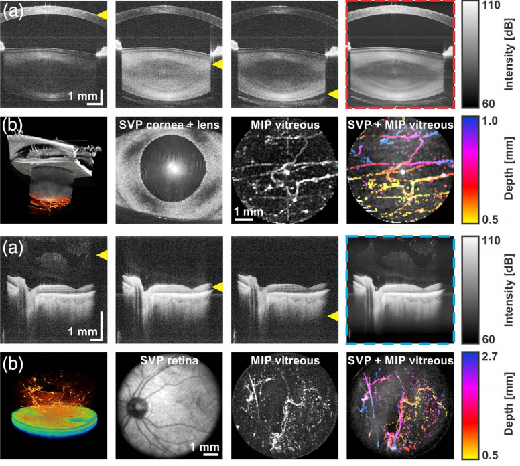 Tunable lenses enable whole-eye imaging with new OCT system | Electro Optics